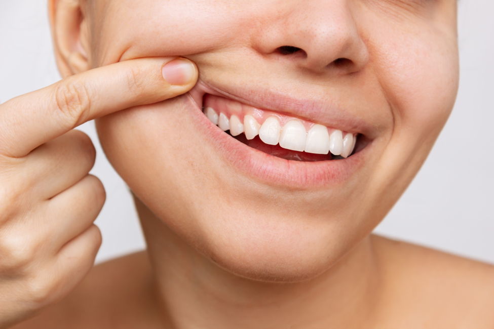 What Causes Gray Teeth? | Webster Lake Dental